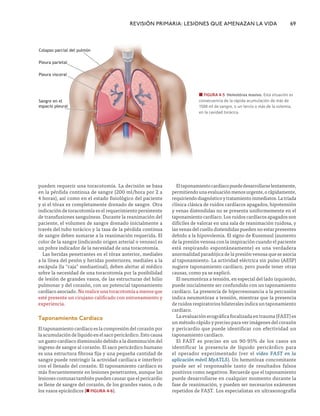 TRAUMA TORÁCICO.pdf
