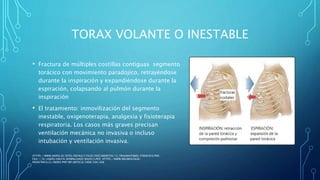 Trauma torácico en el paciente pediatrico | PPT