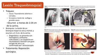 Trauma torácico en cirurgia general .pptx