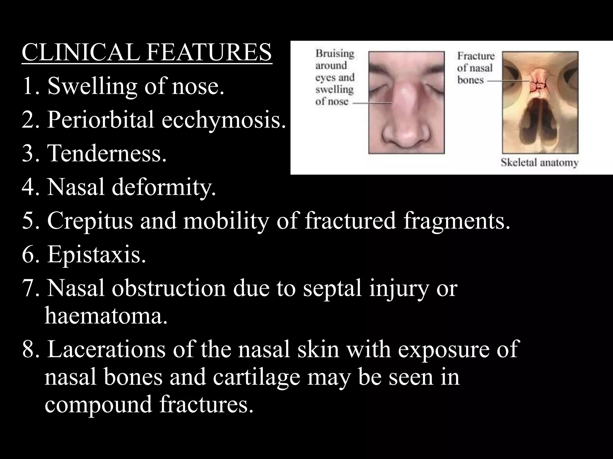 Trauma to the face | PPTX