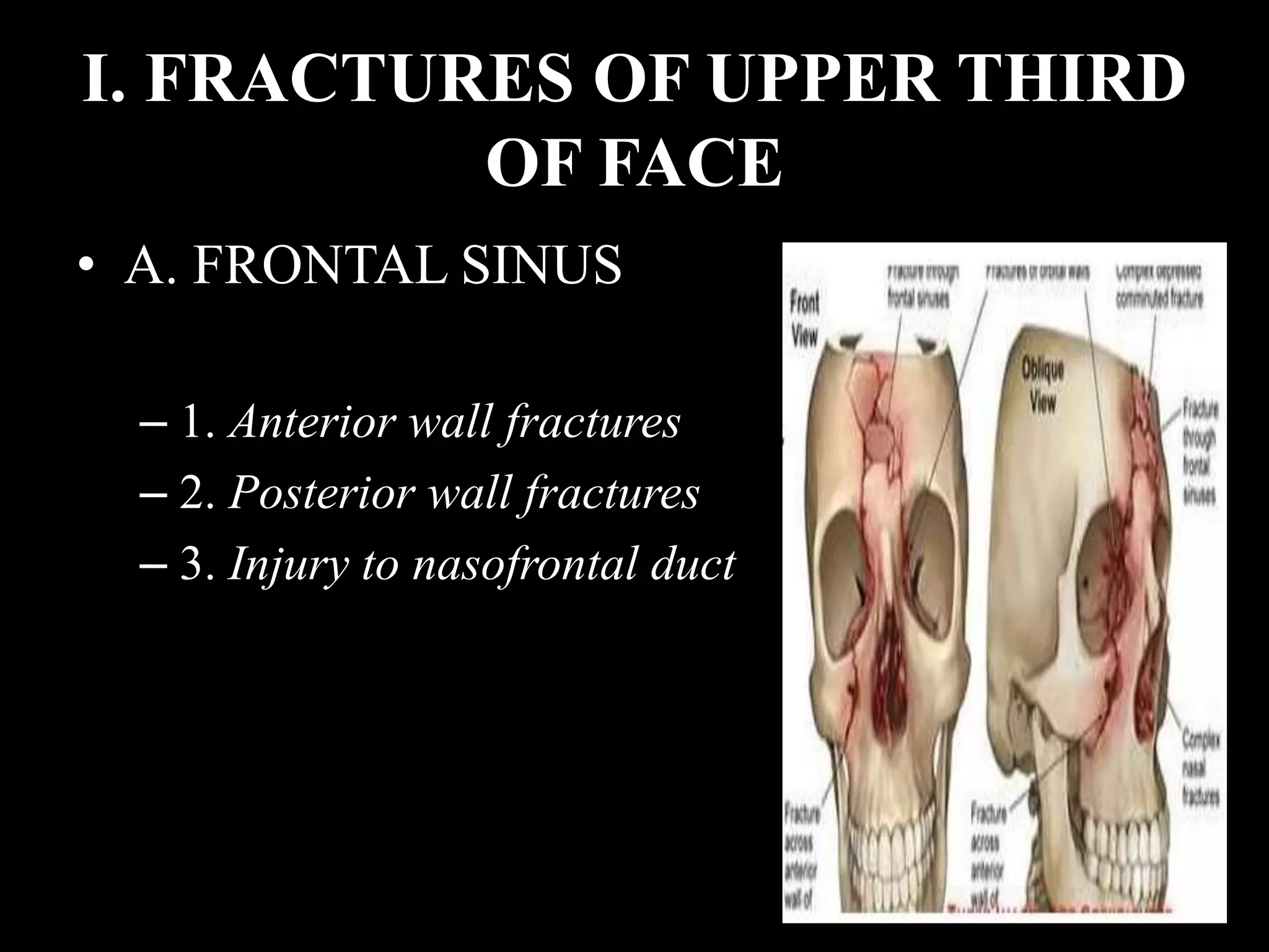 Trauma to the face | PPTX