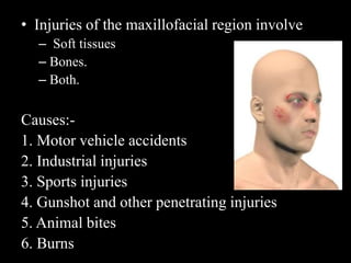 Trauma to the face | PPTX