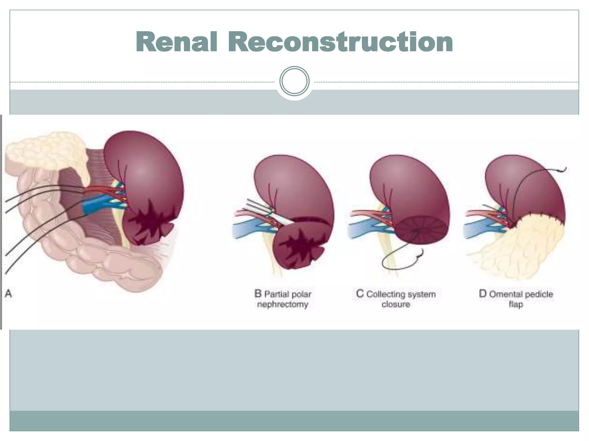 Trauma to the genitourinary tract. | PPTX