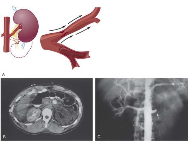 Trauma to the genitourinary tract. | PPTX