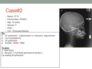 Trauma To The Permanent Maxillary Incisors In The Mixed Dentition And ...