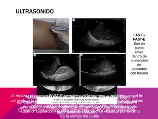TRAUMATÍSMO TORACICO Y ABDOMINAL.pptx