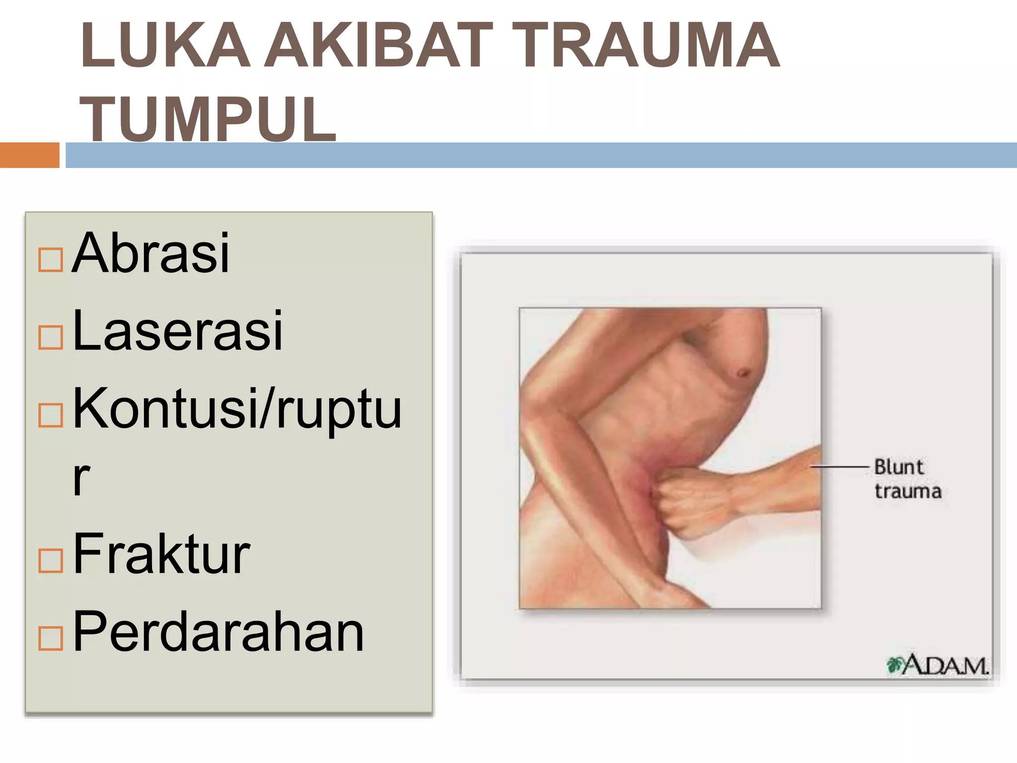 Trauma tumpul | PPTX