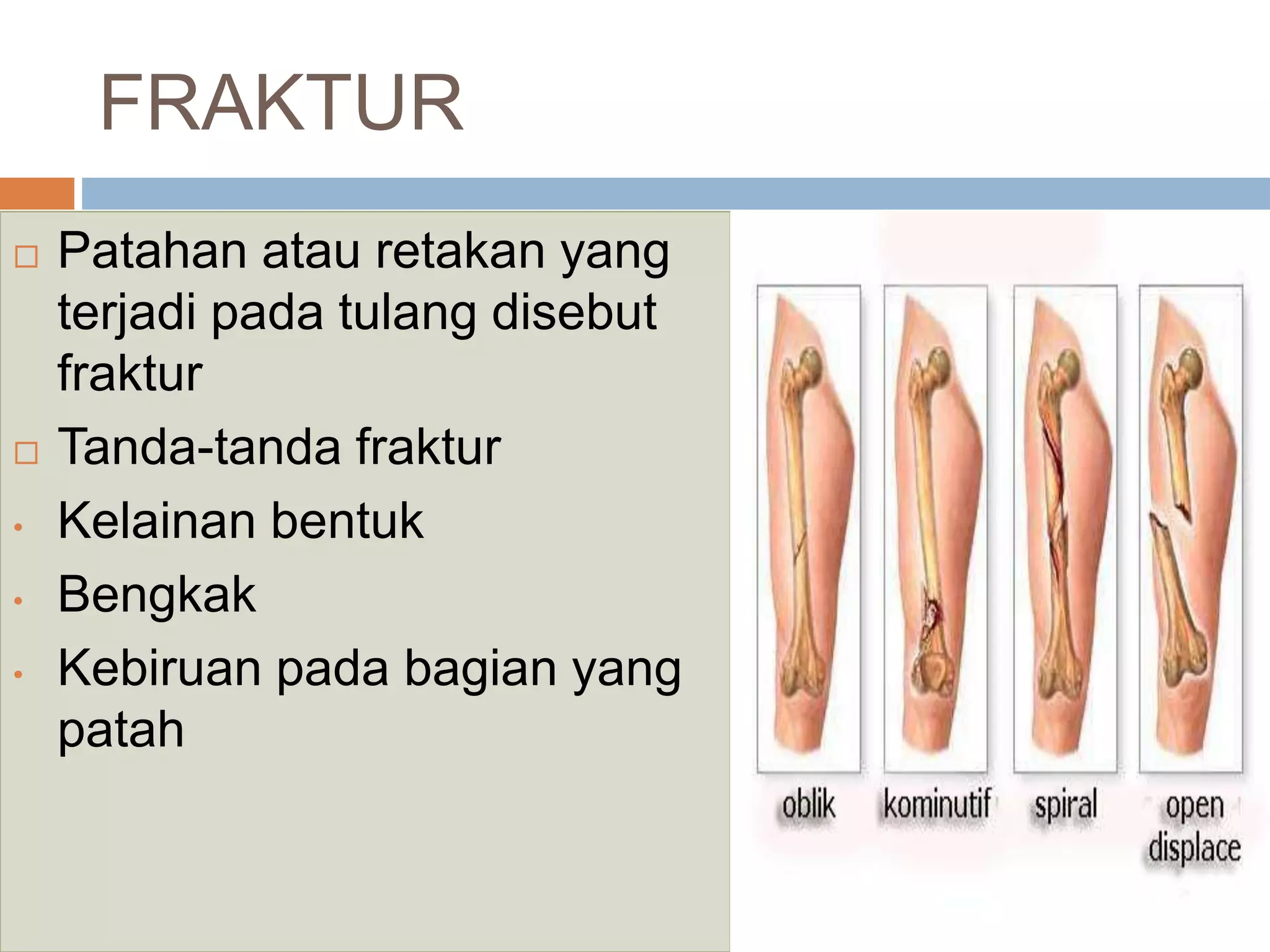 Trauma tumpul | PPTX