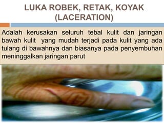 Trauma tumpul | PPTX