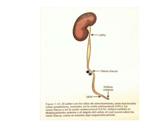 Trauma ureterales