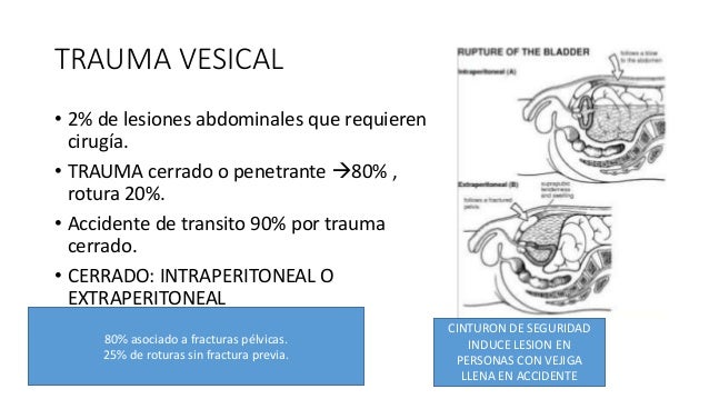 Trauma uretral y vesical urologia