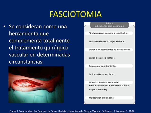 Trauma vascular | PPTX