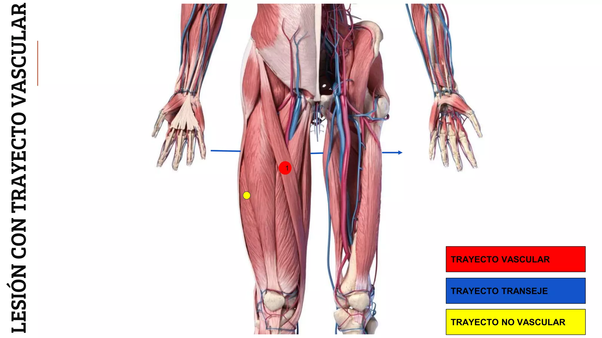 Trauma Vascular | PPT