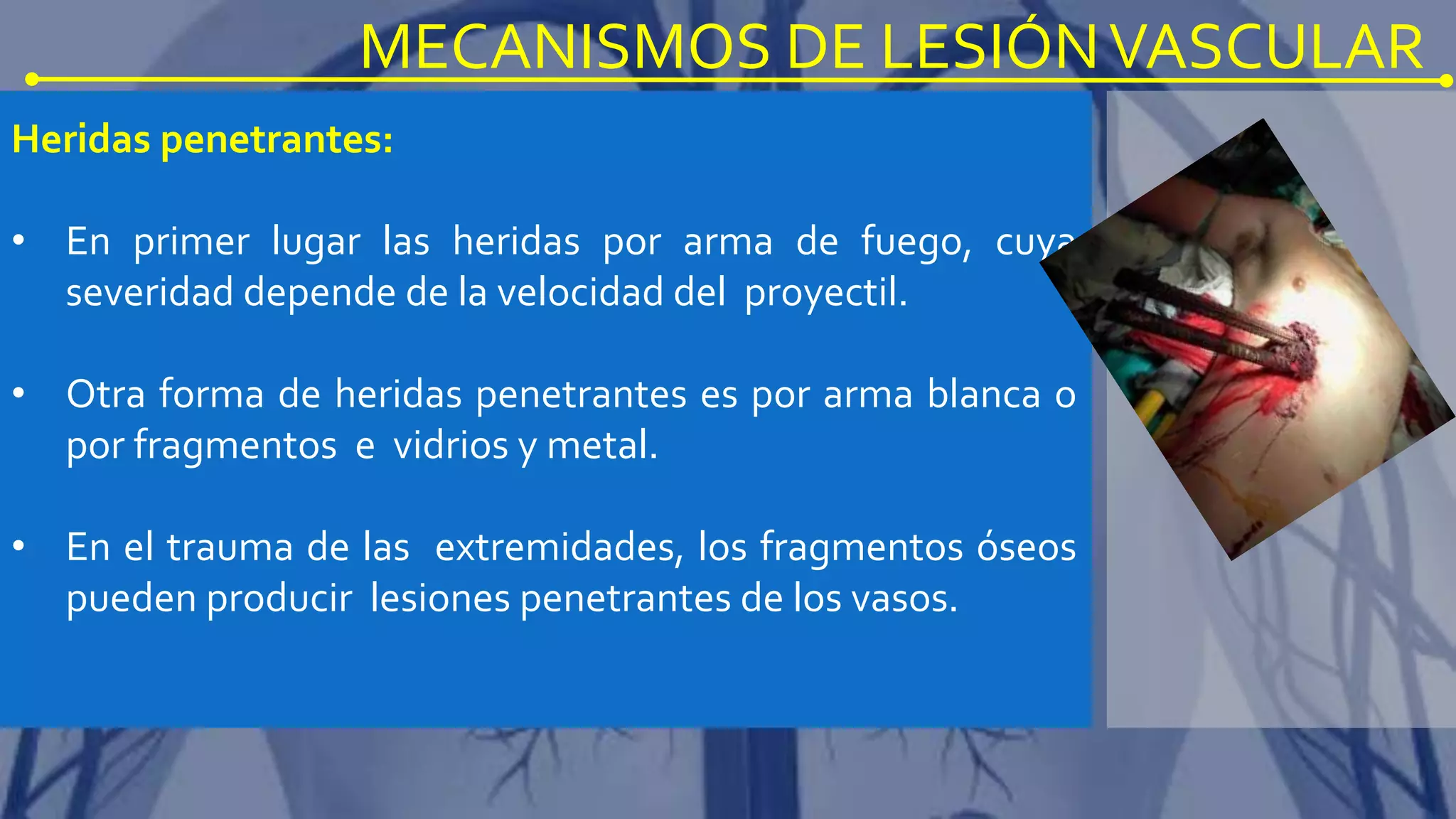 Trauma vascular jonathan molina | PPTX