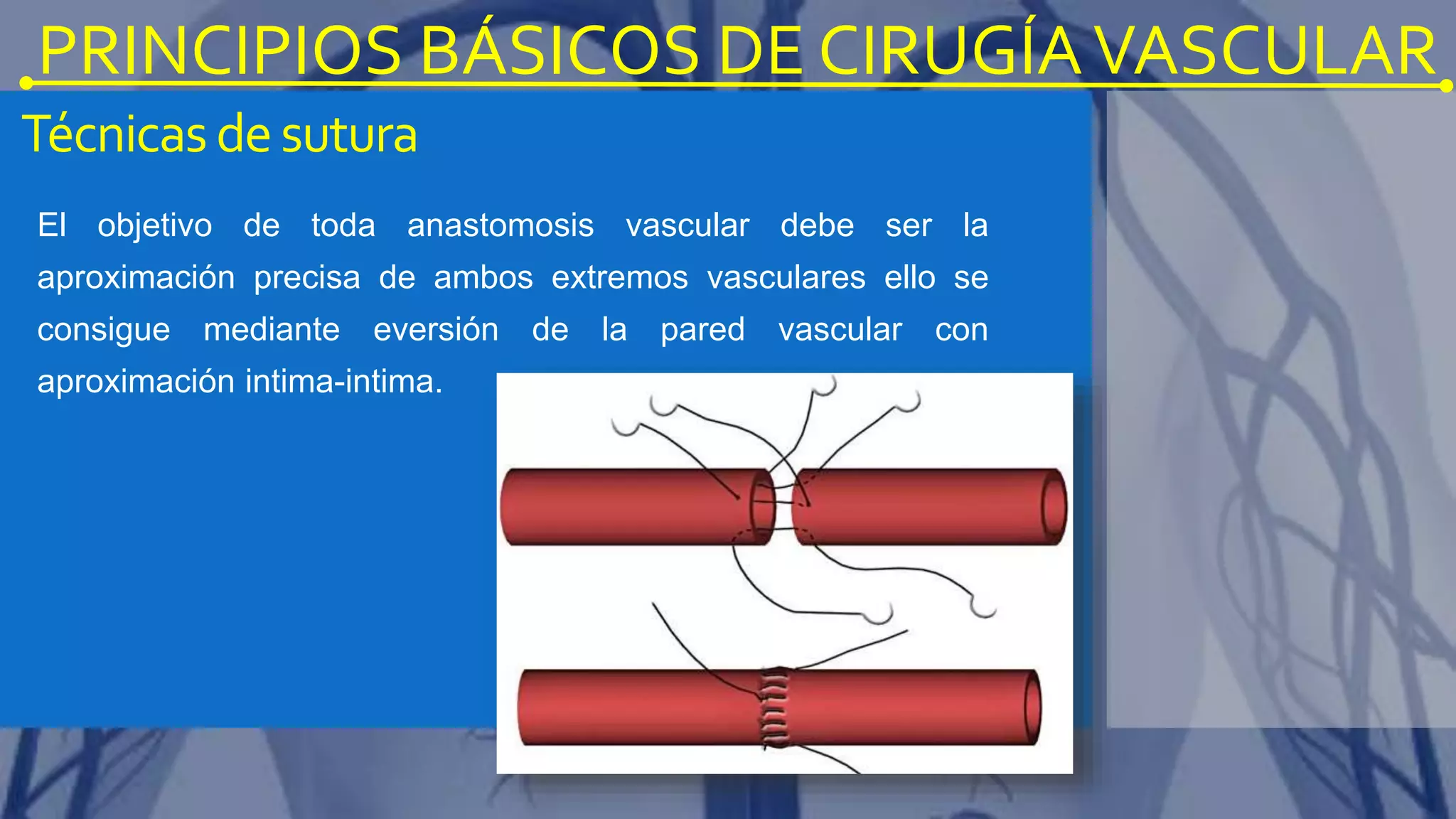 Trauma vascular jonathan molina | PPTX
