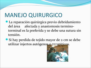 Trauma vascular periferico | PPT