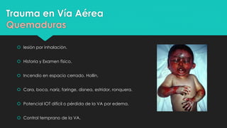 Trauma via aerea | PPTX