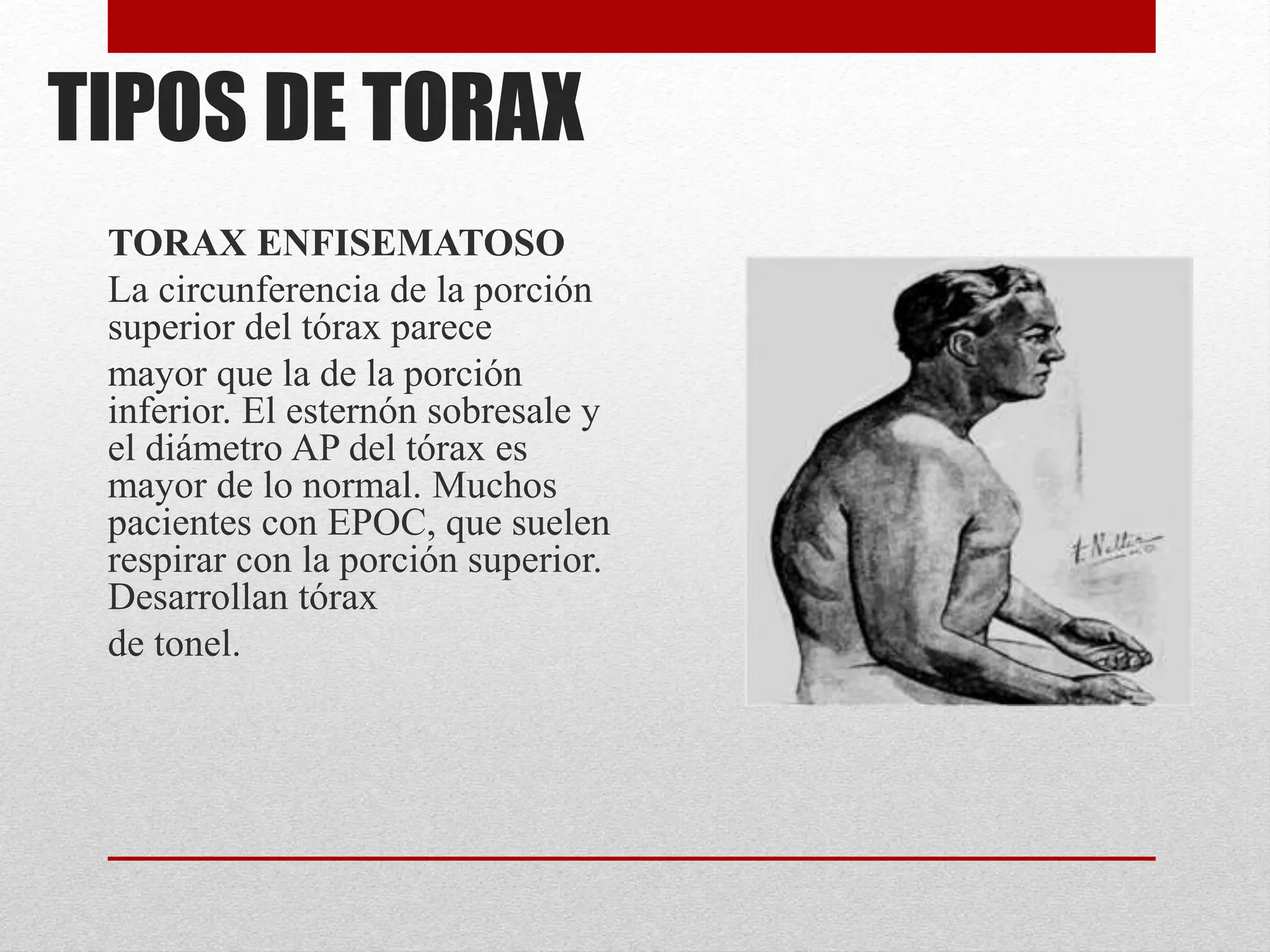 Generalidades y Deformidades del Tórax.pptx