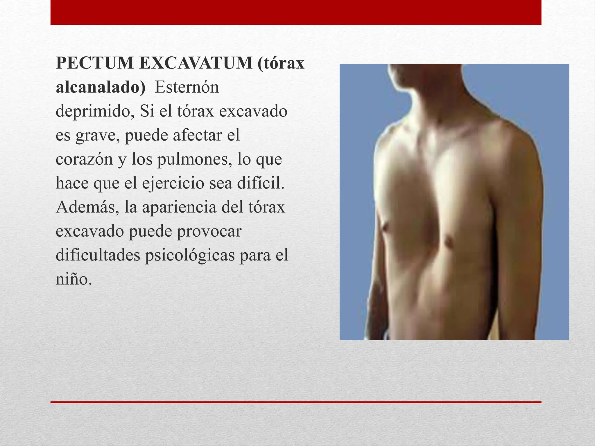 Generalidades y Deformidades del Tórax.pptx