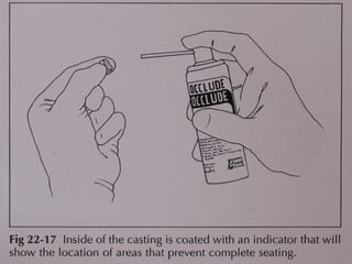 TRAY IN OF Fixed Partial Dentures, Materials & steps | PPT