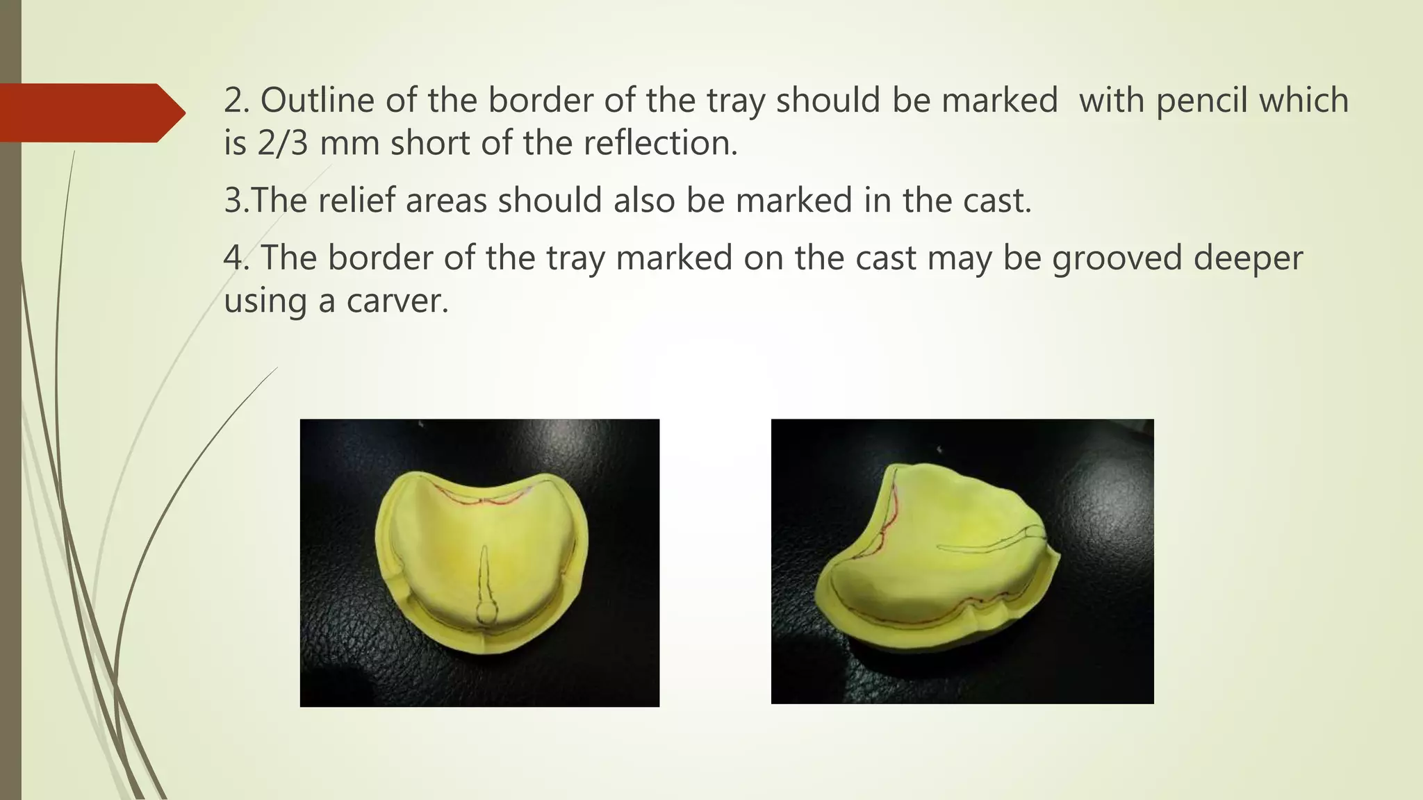 Beginner Guide to Impression Trays in Dentistry | PPTX