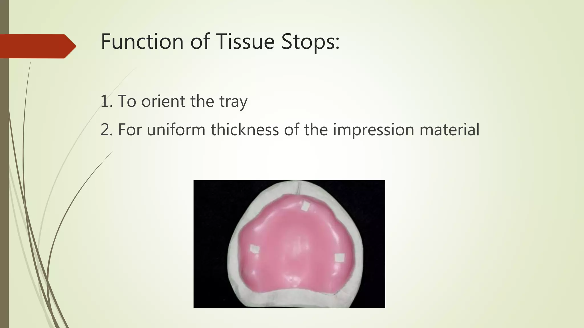 Beginner Guide to Impression Trays in Dentistry | PPTX