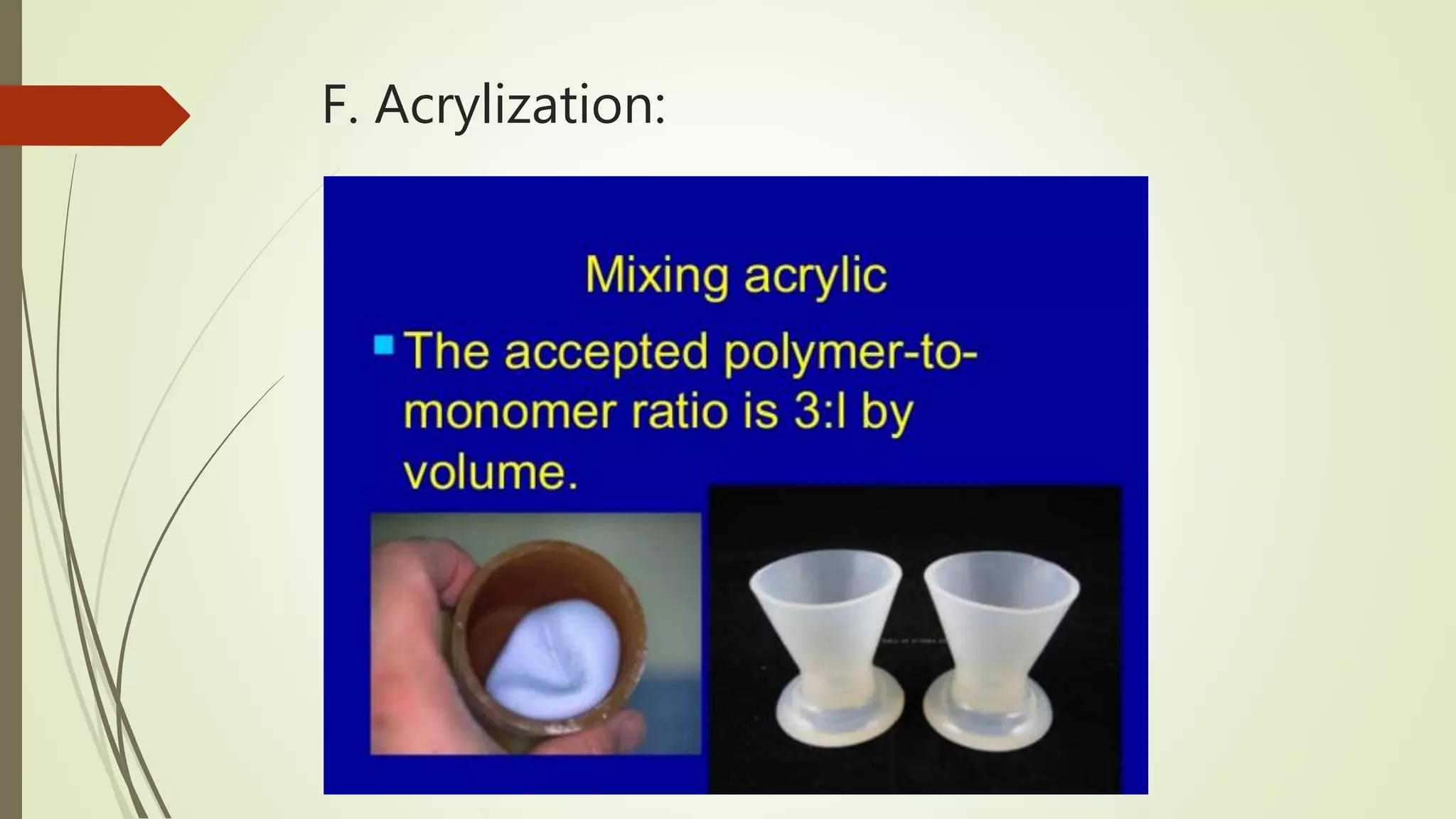 Beginner Guide to Impression Trays in Dentistry | PPTX