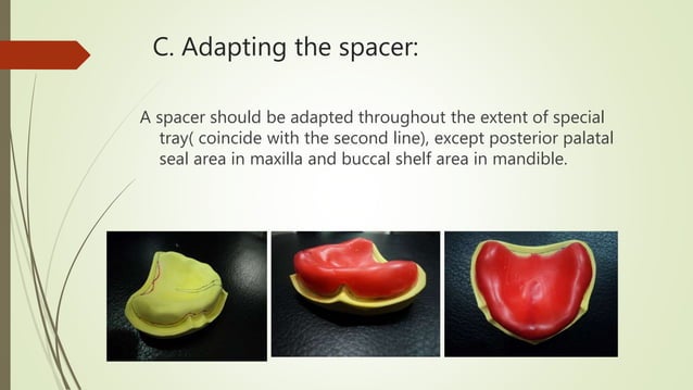 Beginner Guide to Impression Trays in Dentistry | PPTX | Oral care ...
