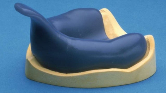 Beginner Guide to Impression Trays in Dentistry