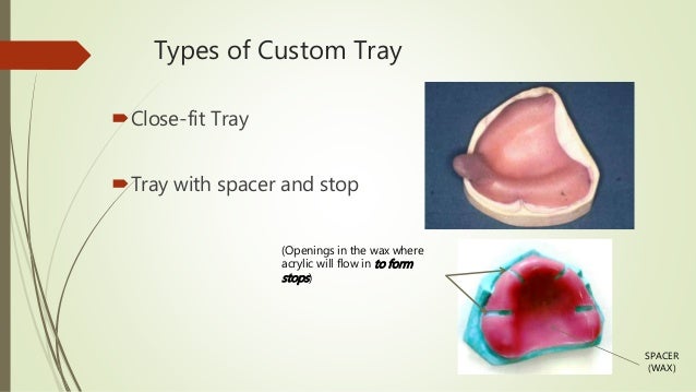 Beginner Guide to Impression Trays in Dentistry