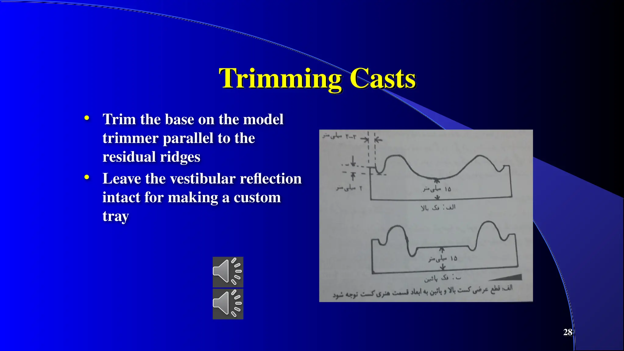 Tray selection and preliminary impression2.pptx