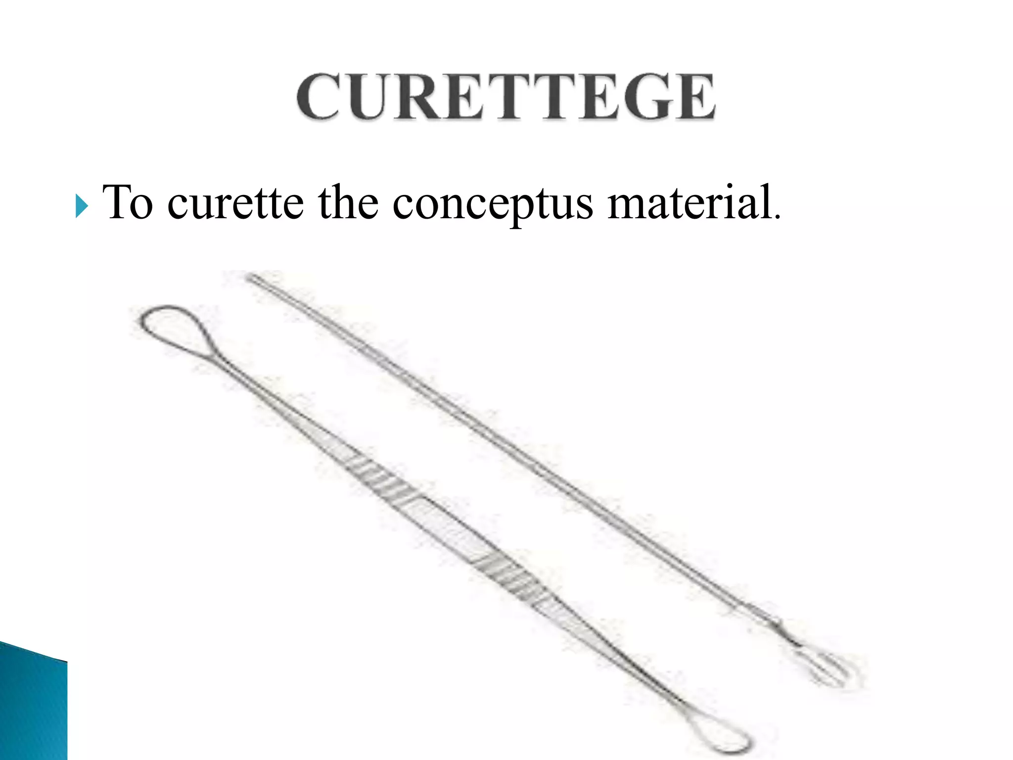 Tray setting for dilatation and curratage | PPTX