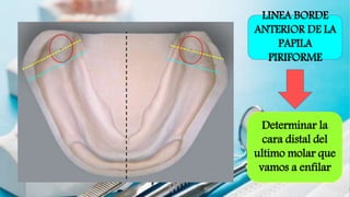 TRAZOS DEL MAXILAR INFERIOR.pptx
