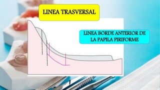 TRAZOS DEL MAXILAR INFERIOR.pptx
