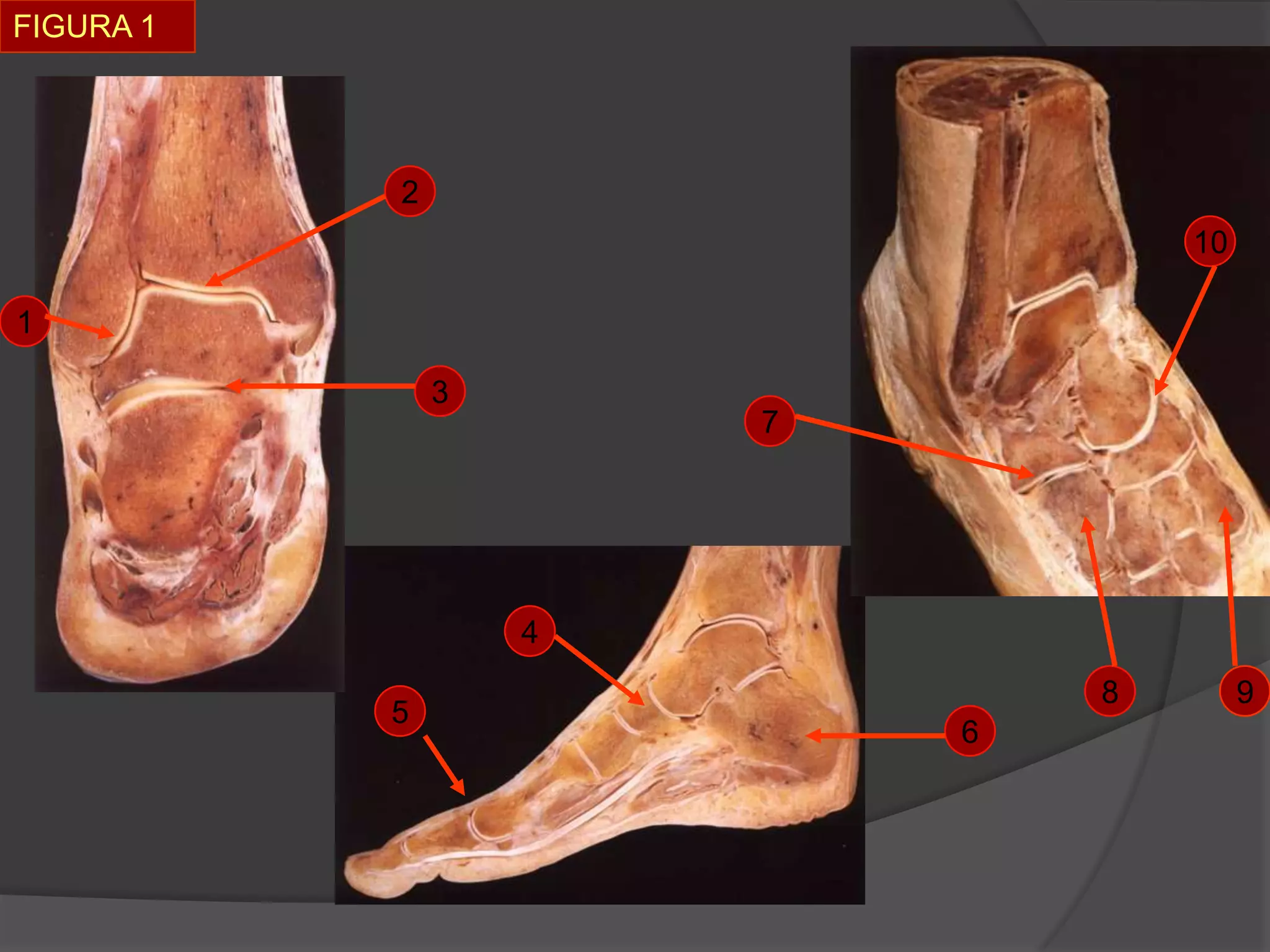 anatomía: músculos del pie | PPTX
