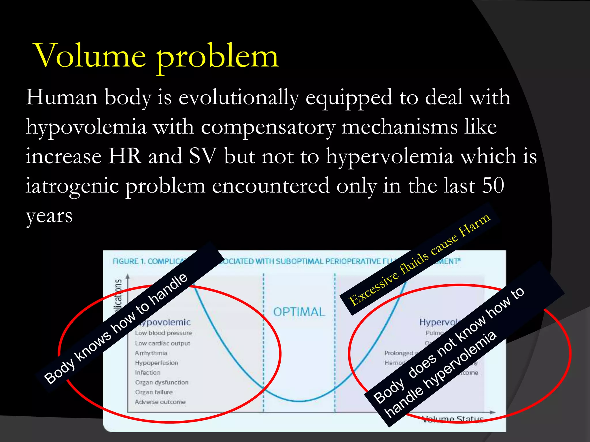 Hypotension management in ICU, volume vessel or pump? | PPTX