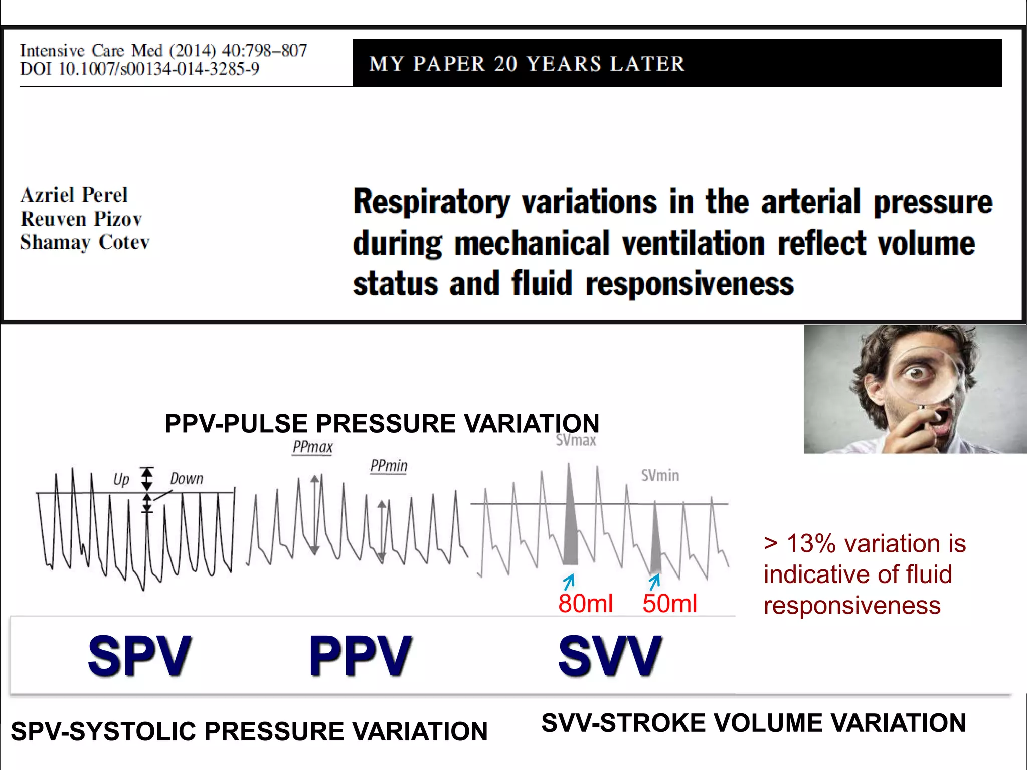 Hypotension management in ICU, volume vessel or pump? | PPTX