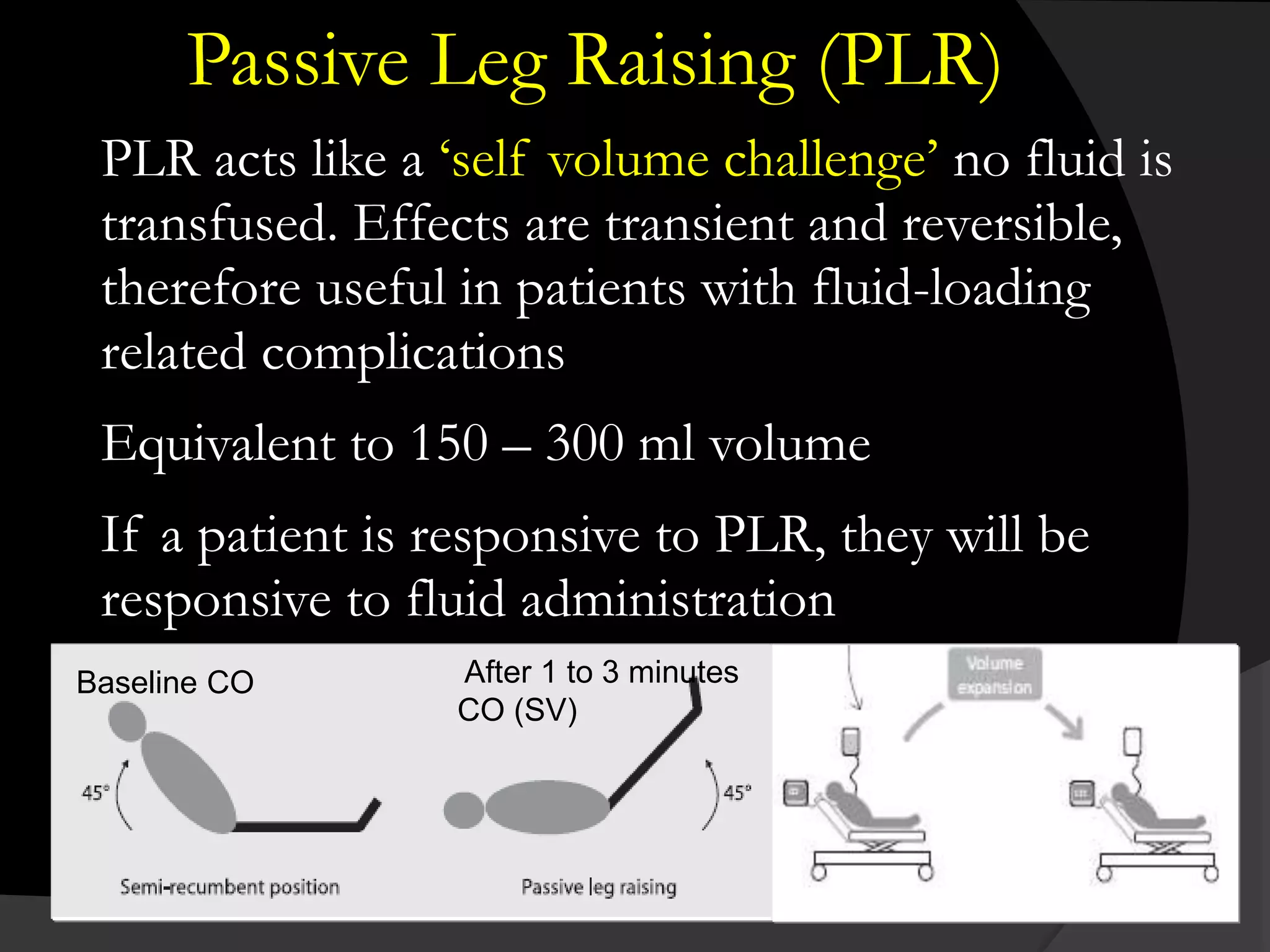 Hypotension management in ICU, volume vessel or pump? | PPTX