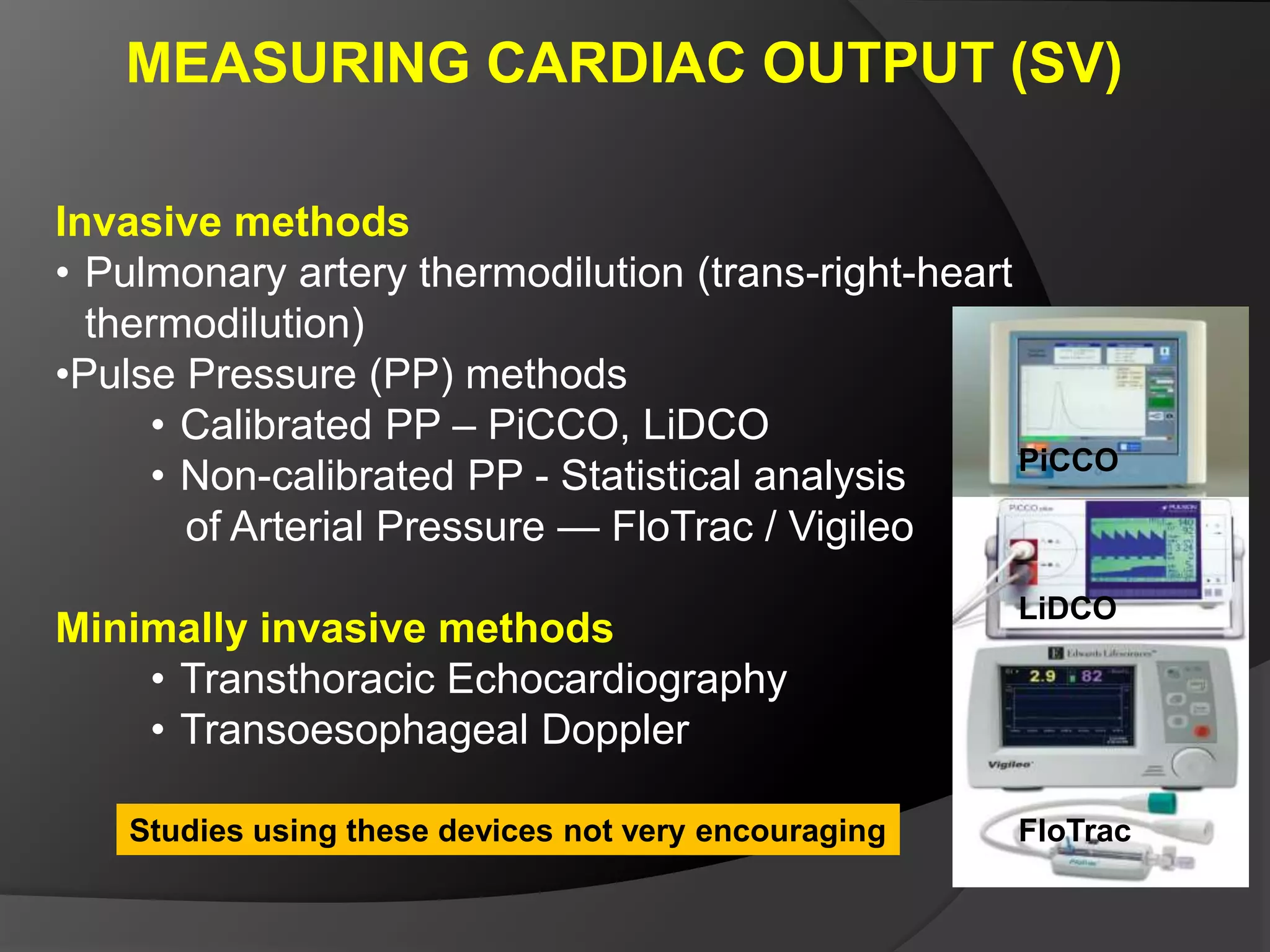 Hypotension management in ICU, volume vessel or pump? | PPTX
