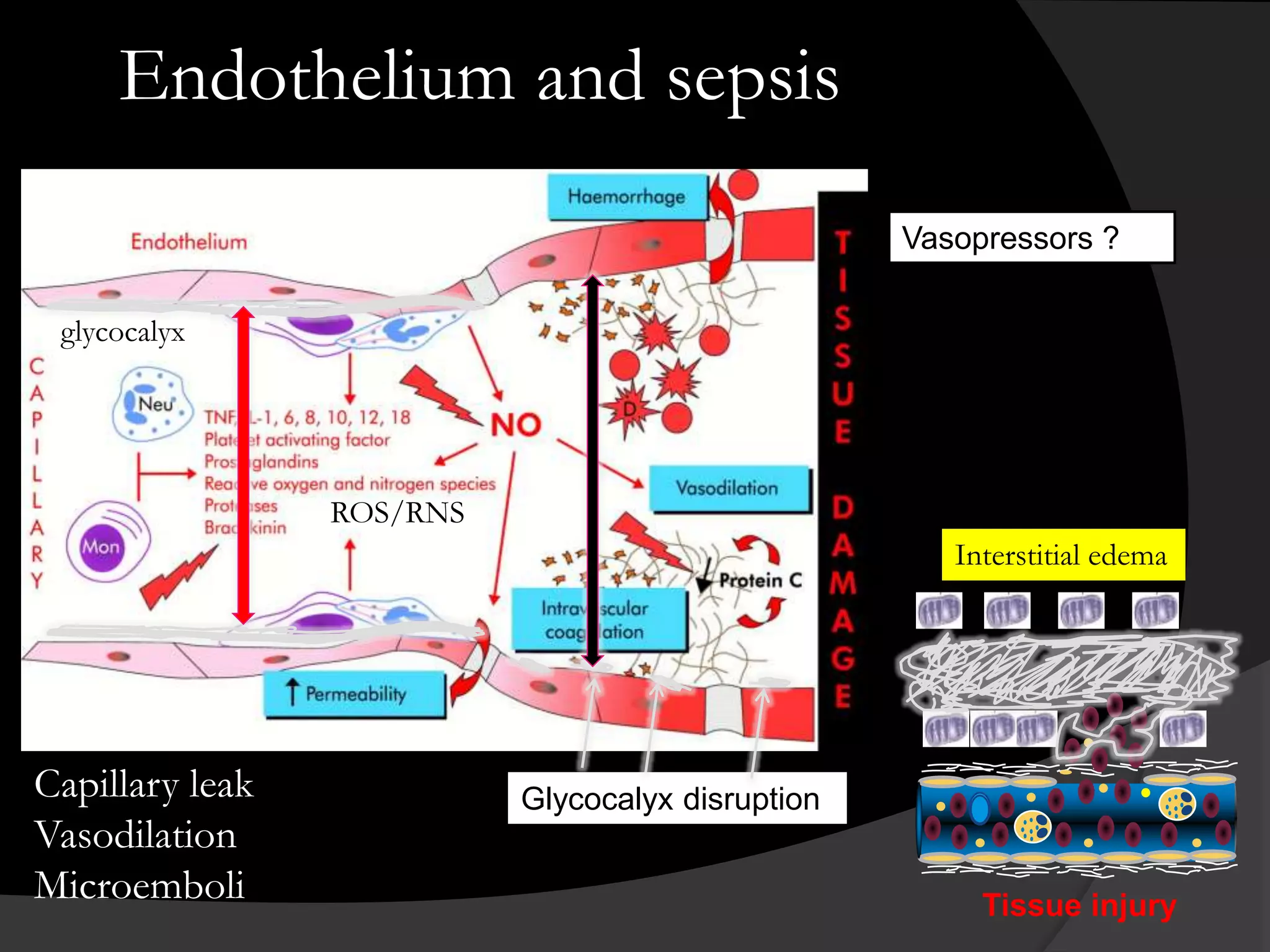 Hypotension management in ICU, volume vessel or pump? | PPTX