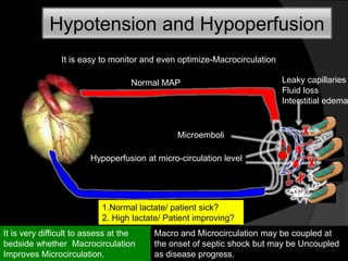 Hypotension management in ICU, volume vessel or pump? | PPTX