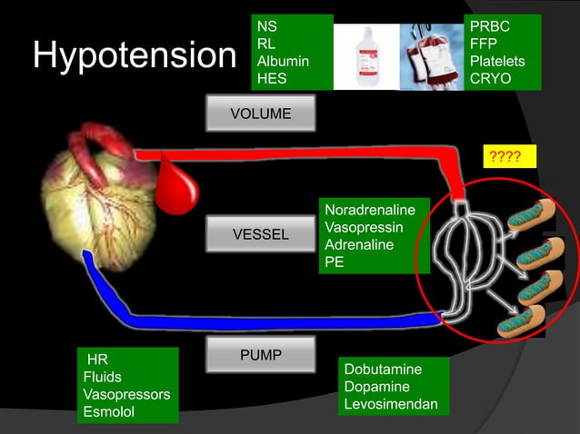 Hypotension management in ICU, volume vessel or pump? | PPTX