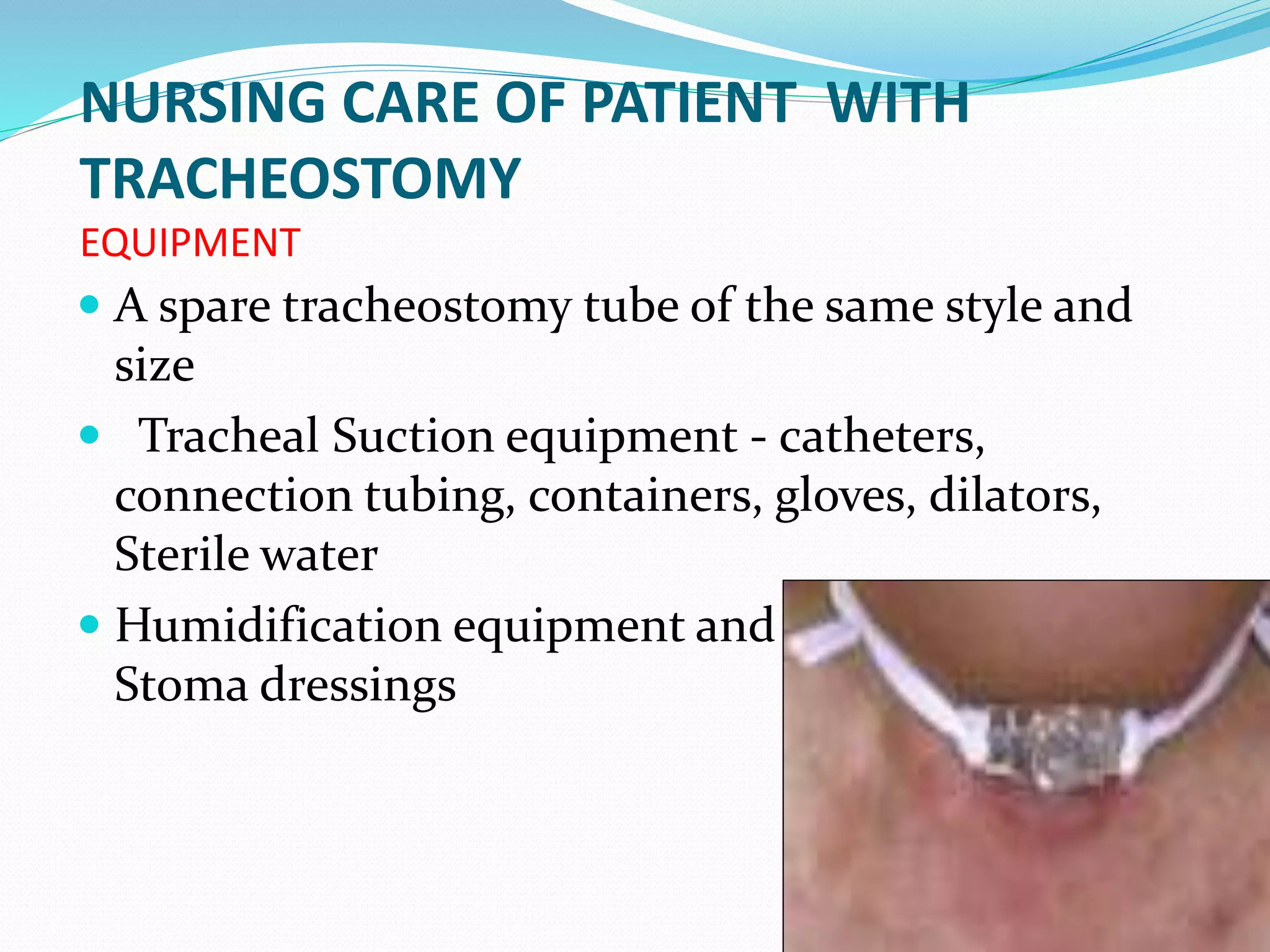Tracheostomy | PPTX