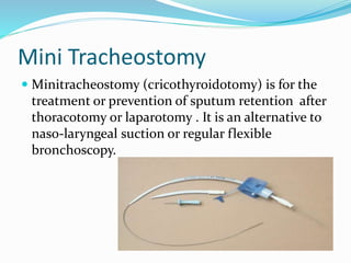 Tracheostomy | PPTX