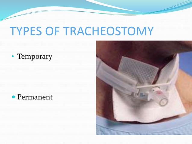 Tracheostomy | PPTX | Lung and Respiratory Health | Diseases and Conditions