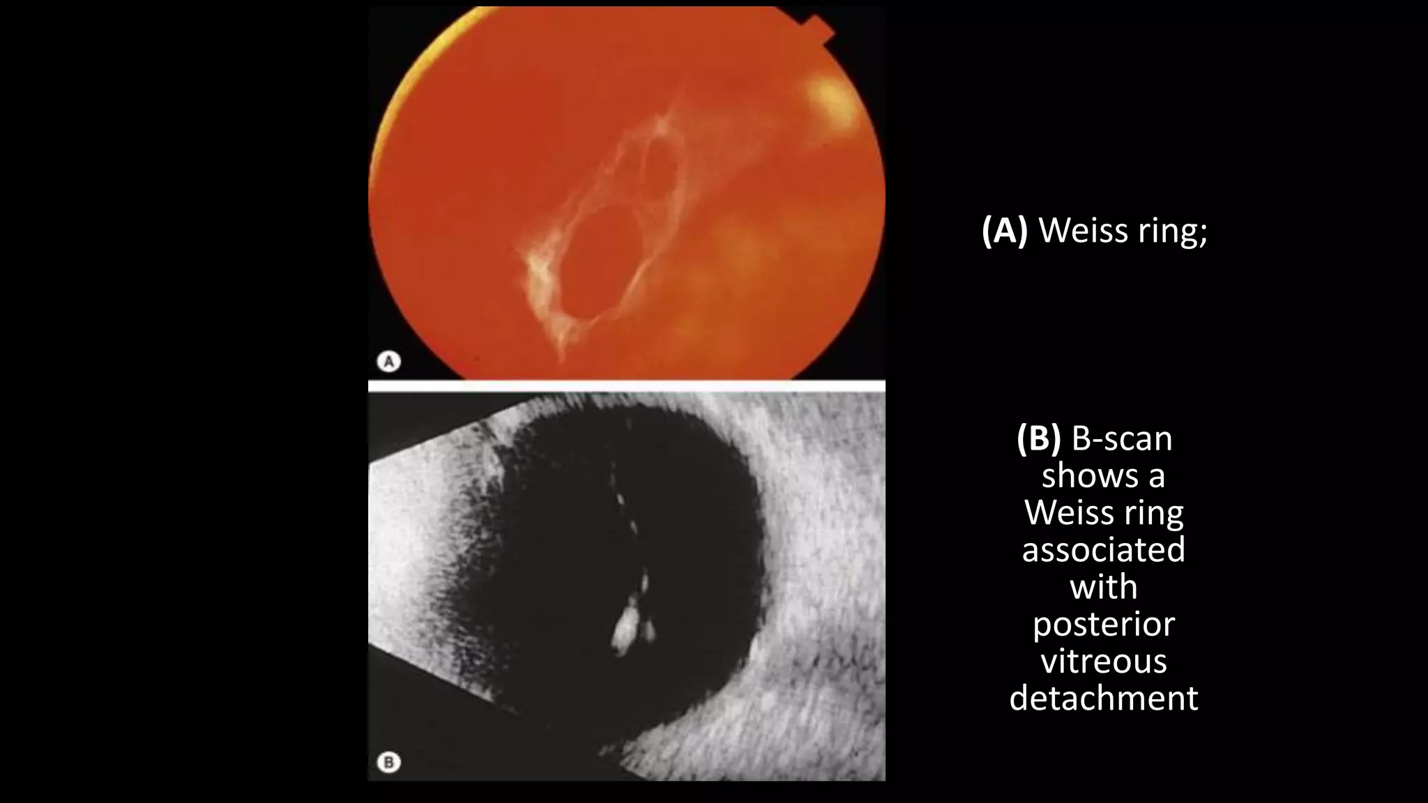 Tractional RD | PPTX