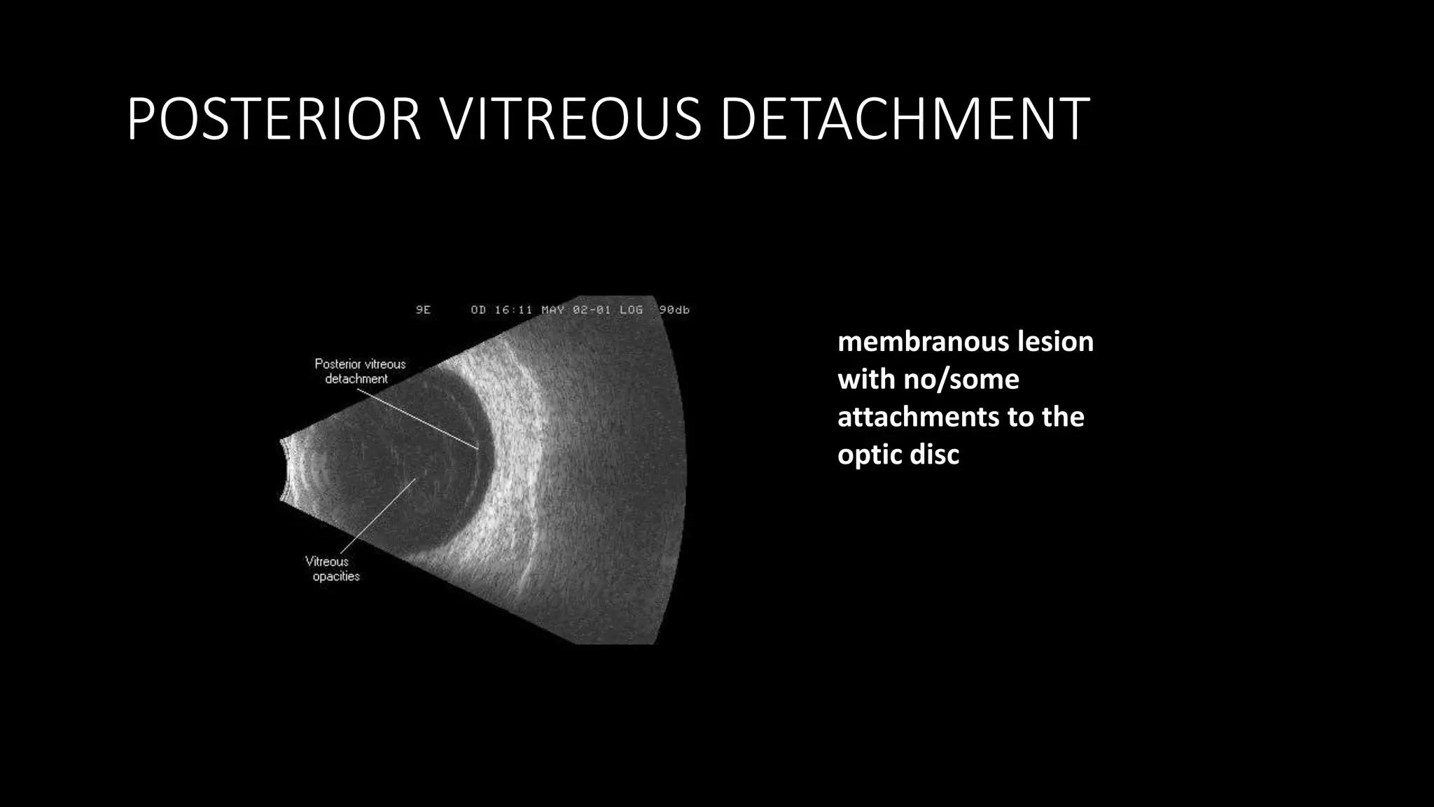 Tractional RD | PPTX