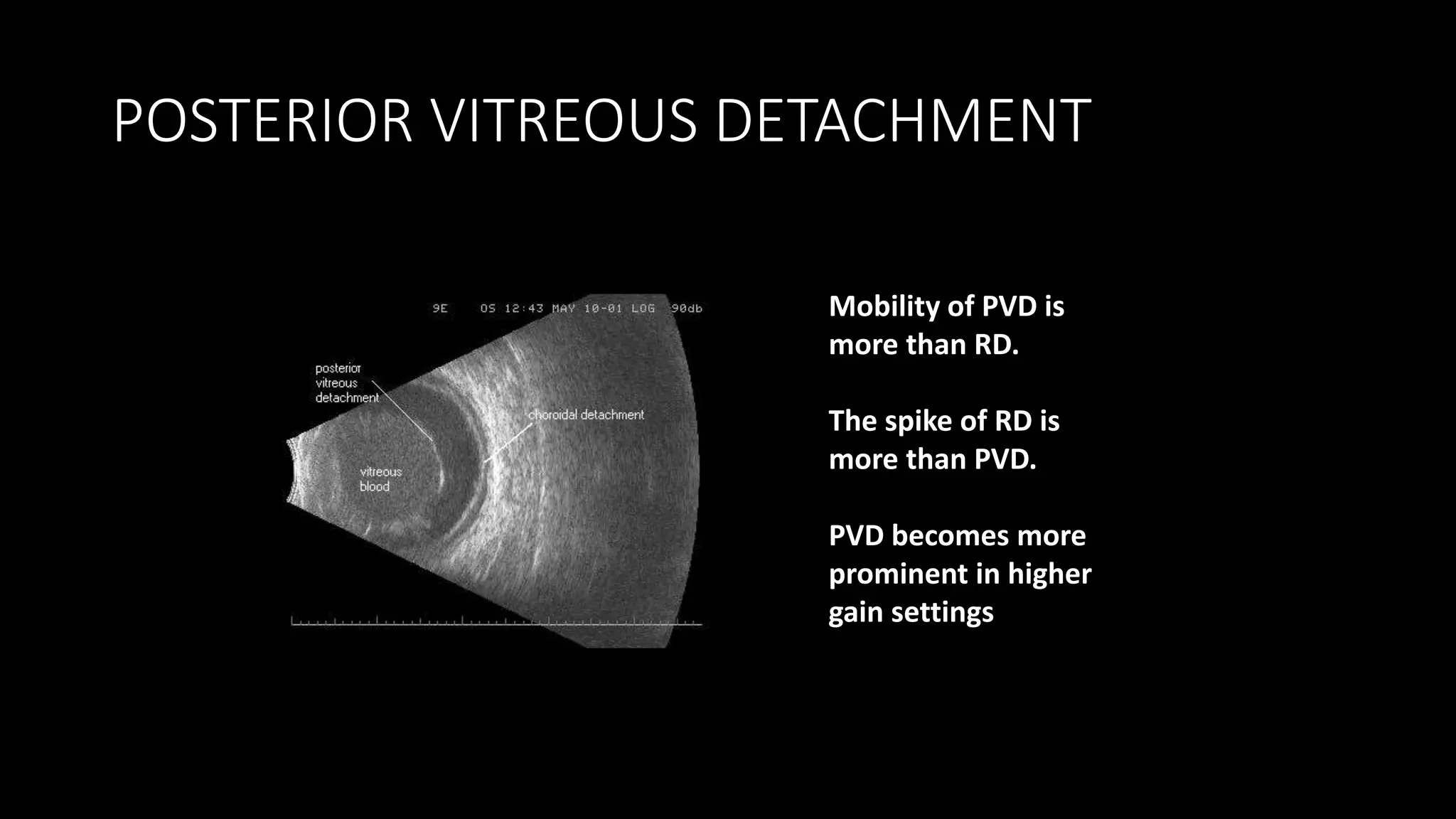 Tractional RD | PPTX