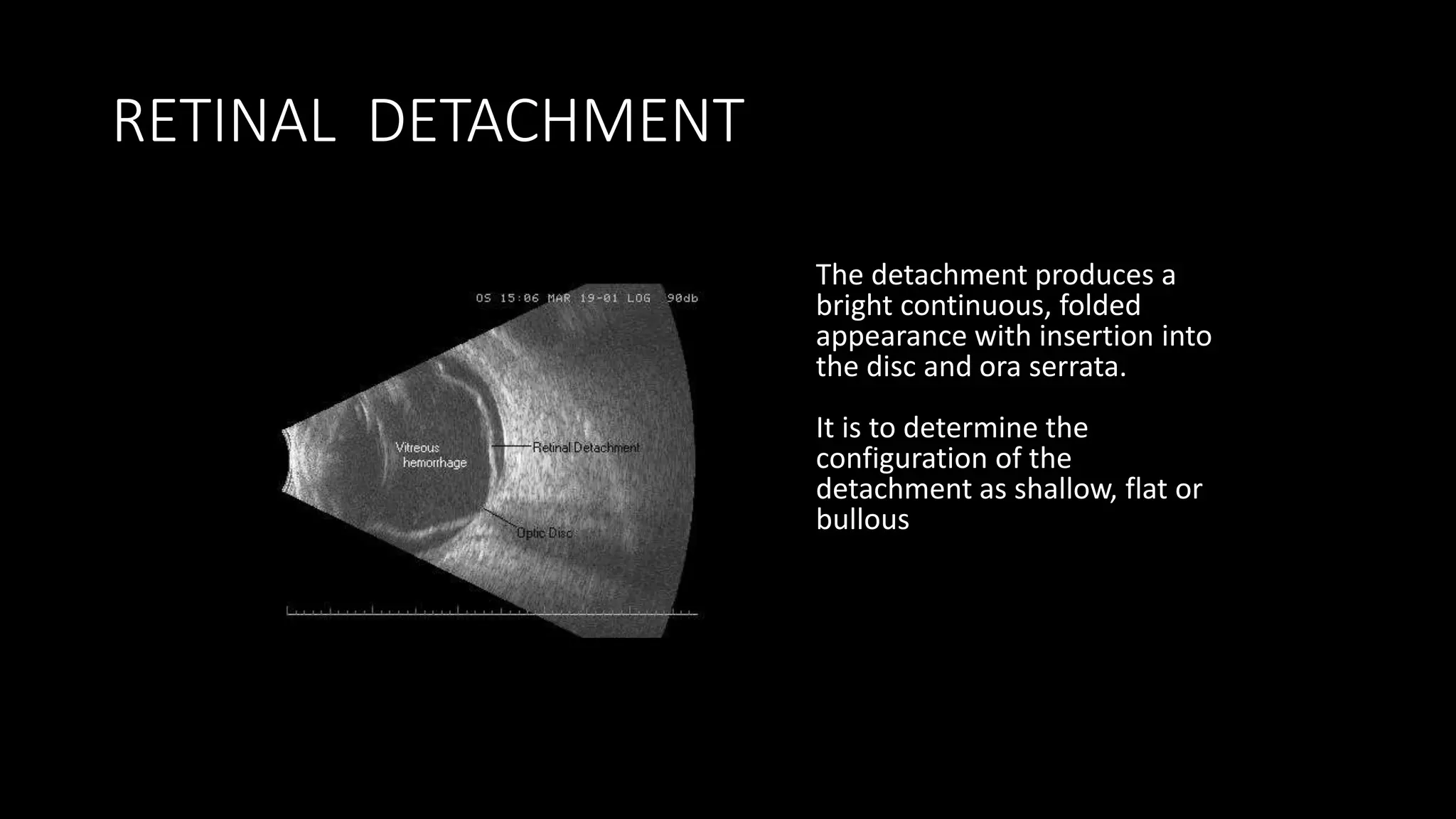 Tractional RD | PPTX