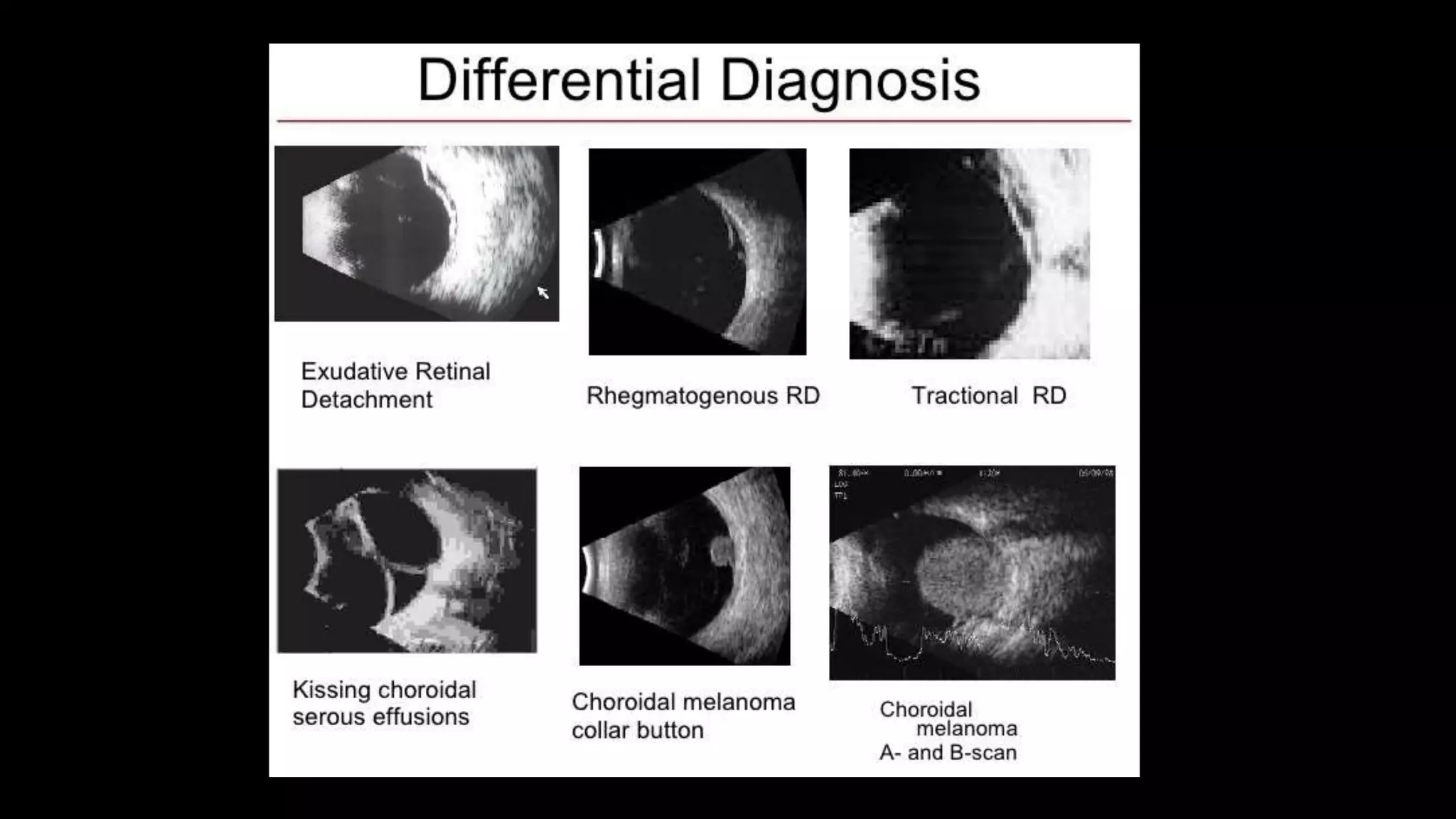 Tractional RD | PPTX